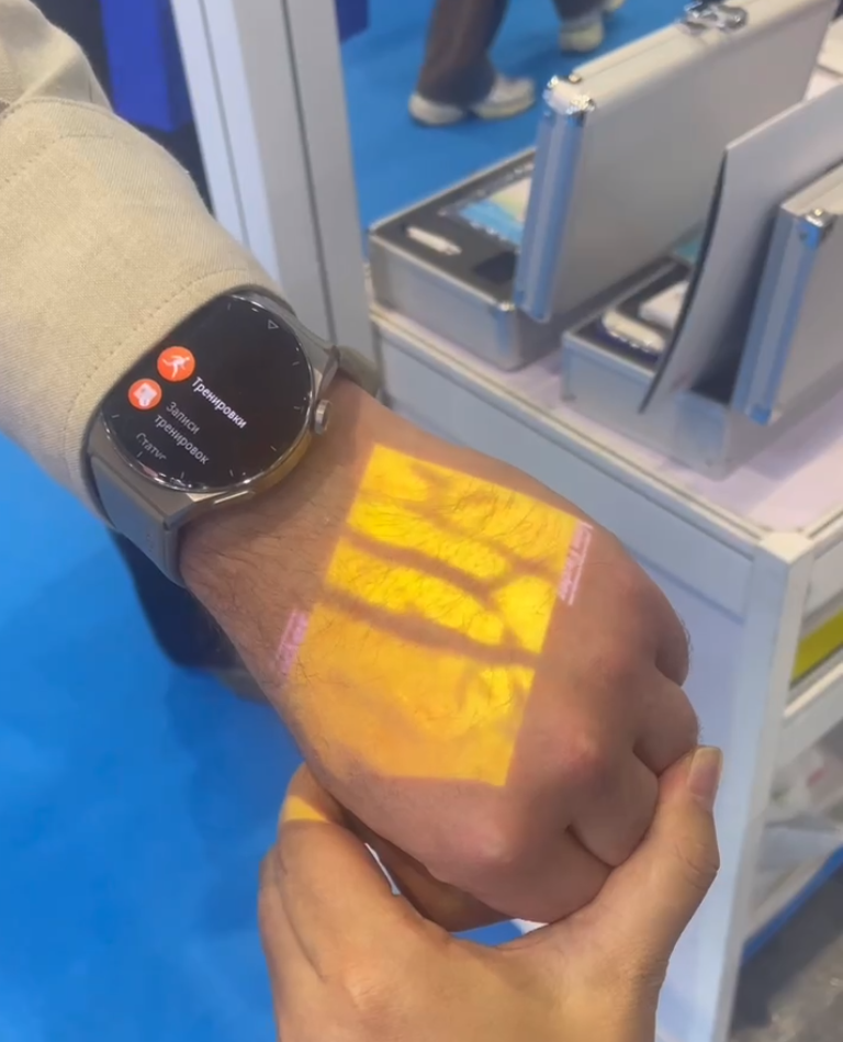 Do vein finders show arteries? - Qualmedi - qualmedi