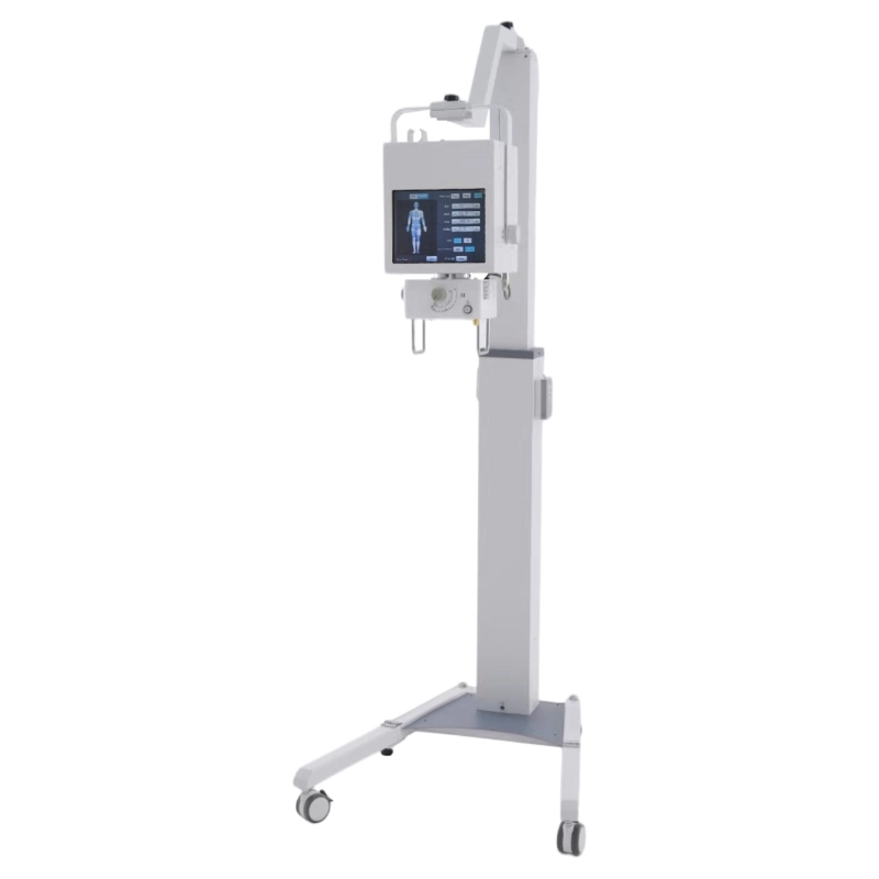 QMDR-50/53/56/80 Mobile Digital Radiography X-ray System - Qualmedi ...